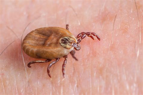 Tick Bites How To Avoid Them And What To Do If You Get Bitten BBC