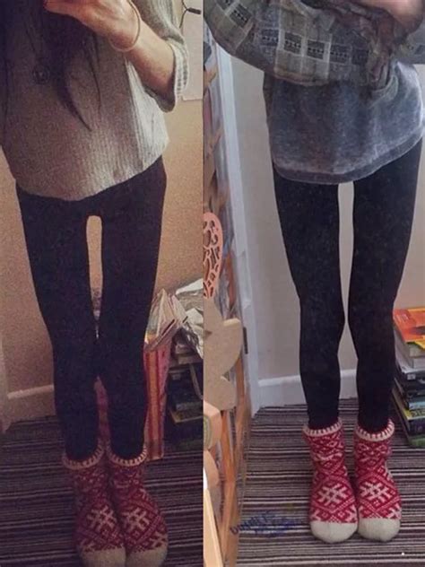 Really Skinny Girls With Thigh Gaps