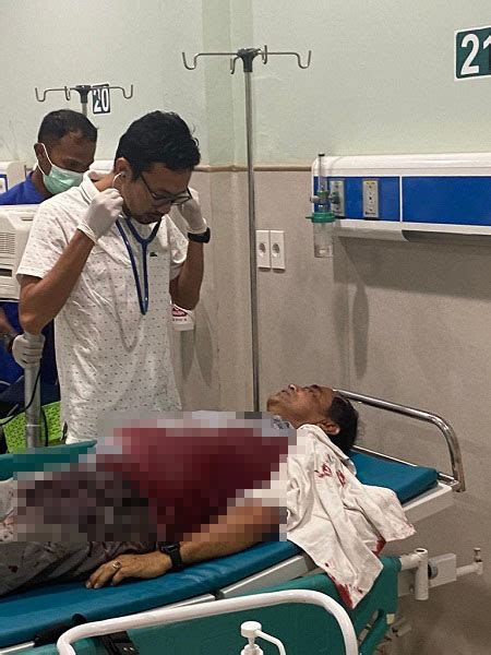Breaking News Mobil Pj Bupati Aceh Timur Kecelakaan Di Pijay