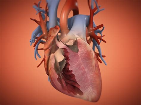 Video Hypoplastic Left Heart Syndrome HLHS HealthClips Online
