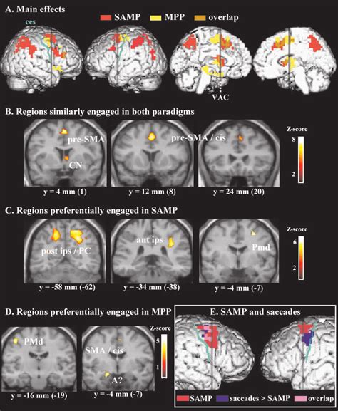 functional mri results a activation patterns shown on lateral and download scientific diagram