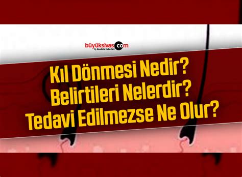 Kıl Dönmesi Nedir Belirtileri Nelerdir Tedavi Edilmezse Ne Olur Büyük