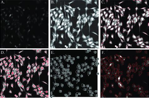progression of the matlab algorithm for cell segmentation and download scientific diagram