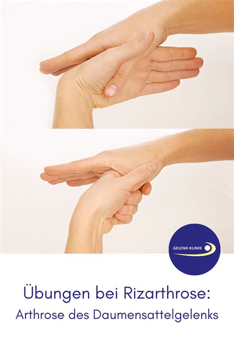 Übungen bei Rizarthrose in 2022 Arthritis Therapie Zyste