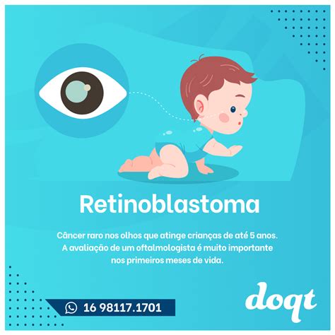 Retinoblastoma C Ncer Raro Nos Olhos Que Atinge Crian As De At An