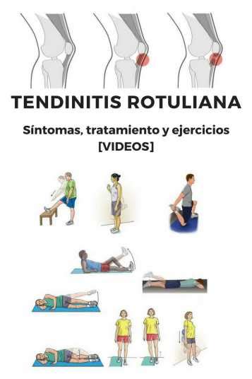TENDINITIS ROTULIANA Qué hacer para quitar el dolor en la rodilla