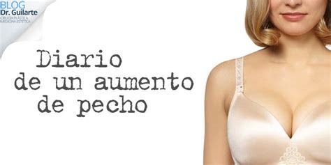 Recuperacion Aumento De Senos Atelier Yuwa Ciao Jp