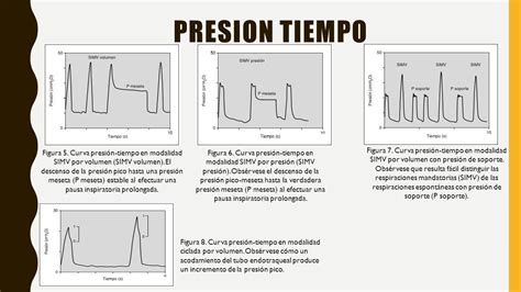 MONITOREO GRAFICO VENTILATORIO CURVAS Y LAZOS Figura 1 Formas De Onda