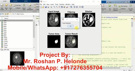 brain tumor detection and classification using image processing matlab source code ~ engineering
