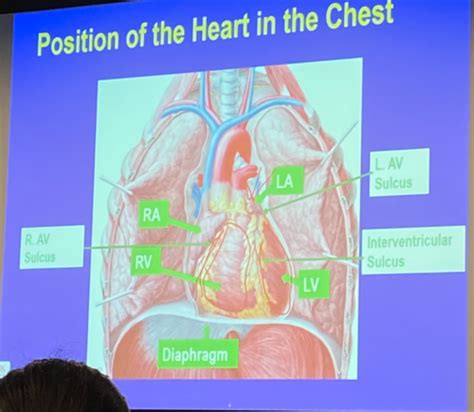 Acute Coronary Syndrome ACS Flashcards Quizlet