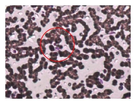 Platelet Aggregation Microscopic Images Of Drug Loaded Naked Surface