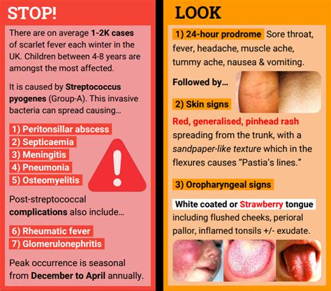 Information For Parents About Strep A The Grange Group Practice