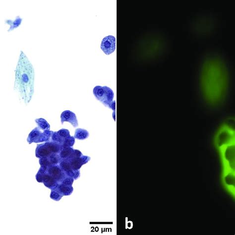Normal Urothelial Cells Intermediate And Deep Urothelial Cells Showing