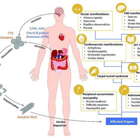 Pathogenesis And Clinical Manifestations Of ATTR Amyloidosis