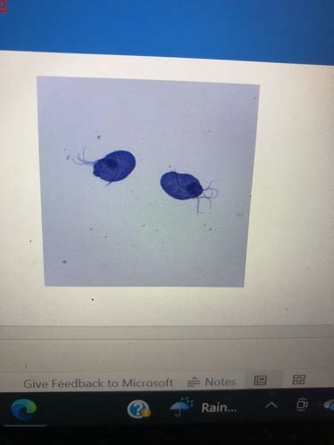 Lab Parasitology Flashcards Quizlet