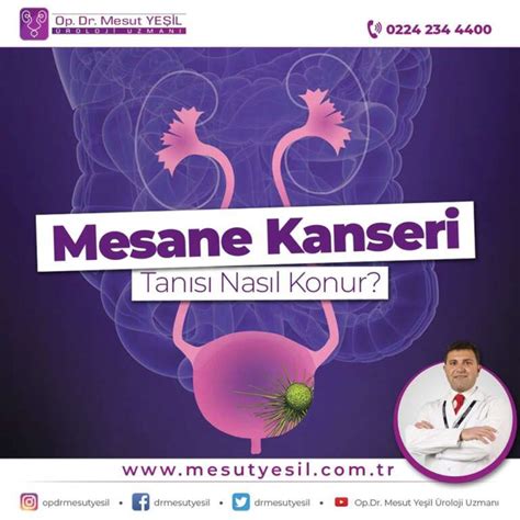 Mesane Kanseri İdrar Torbası Tümörü Üroloji Bursa Böbrek