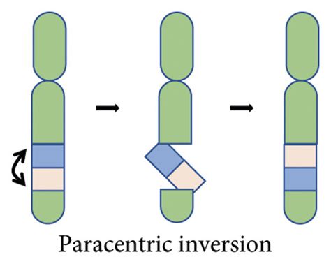 Chromosomal Inversions Two Breaks In The Same Chromosome Causing The