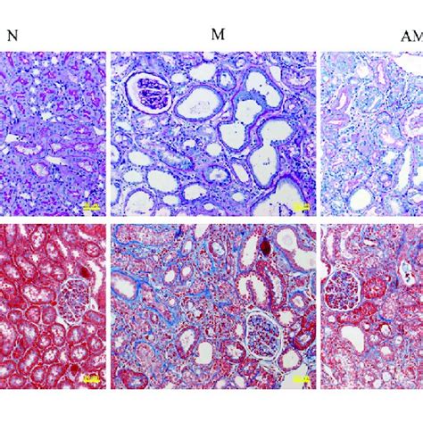 Heatmap Of Hierarchical Clustering Analysis Of The Differential