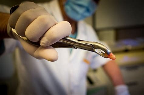 Tipos De Cirug A Dental M S Comunes Clinicadentalferrergarcia