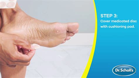 Dr Scholl S How To Use CLEAR Away Wart Remover Plantar For Feet