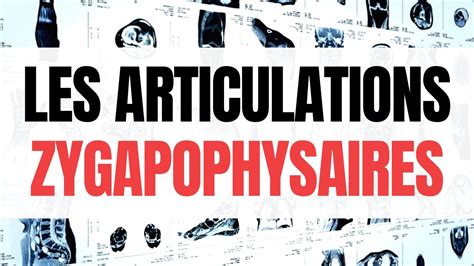 Les Articulations ZYGAPOPHYSAIRES YouTube