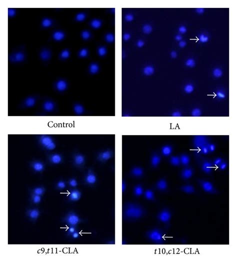 Induction of apoptosis in MCF 7 cells treated with 40 μM c9 t11 CLA