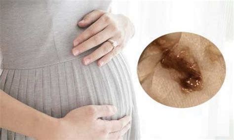 Cách nhận biết chính xác khí hư khi mang thai có màu gì