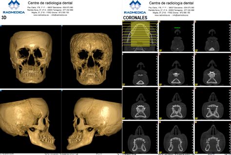 MACIZO FACIAL Radmedica