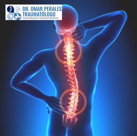 Dolor De Espalda Dr Perales Traumat Logo