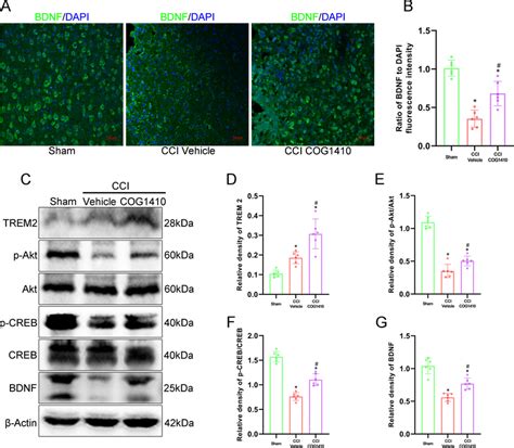 The Akt CREB BDNF Axis Participated In The Neuroprotective Effects Of