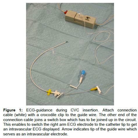 Towards Optimal Central Venous Catheter Tip Position
