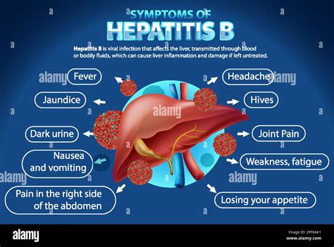 Symptoms Of Hepatitis B Infographic Illustration Stock Vector Image