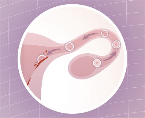 Sangrado de implantación por qué sucede y cómo identificarlo Next