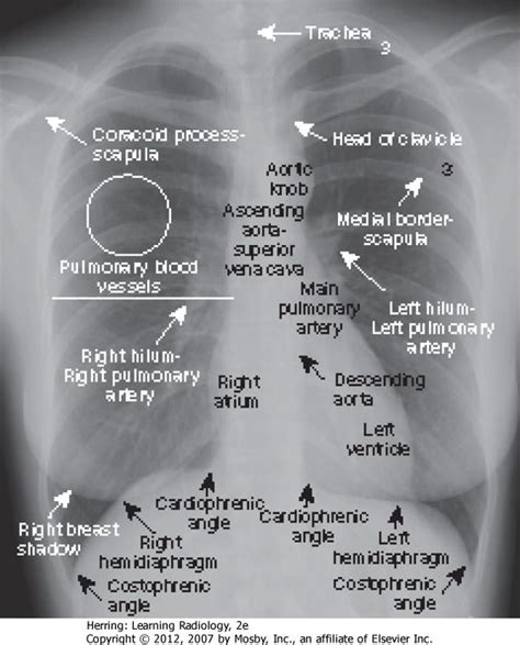 Flashcards Radiology Quizlet Radiology Student Radiology