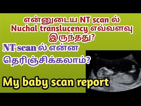 My First Trimester NT Scan Report In Tamil Prenatal Screening Test L