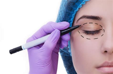 Ptosis Palpebral Qu Es Causas Y Tratamiento Face Clinic