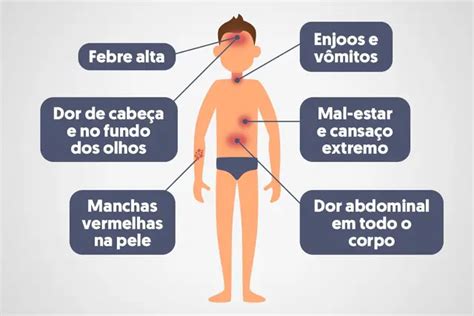 Como Fazer Soro Caseiro Para Quem Está Dengue Saúde Cultura Mix