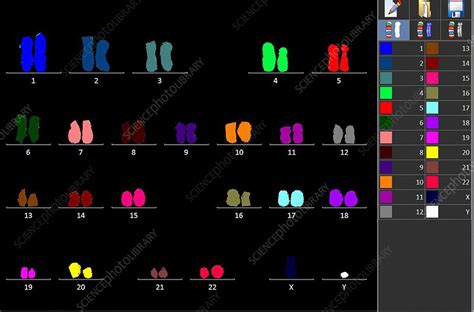 Human Male Karyotype Stock Image C016 6733 Science Photo Library