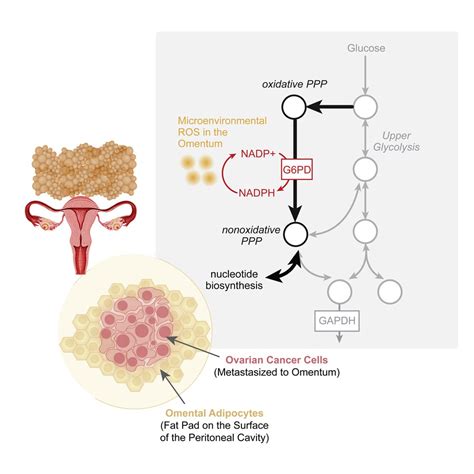 Ovarian Cancer In The Fatty Omentum Metabolic Enzyme S Key Role In
