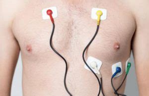Cómo saber Dónde colocar los Electrodos Corporales
