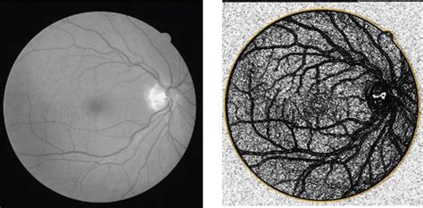 active contour based segmentation techniques for medical image analysis intechopen