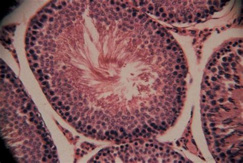 Sch Ma Coupe De Testicules Diagram Quizlet