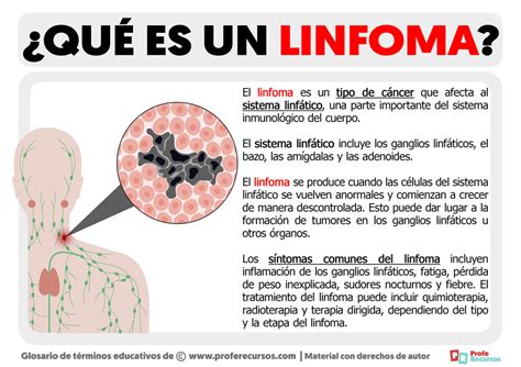 Qué es un Linfoma Definición de Linfoma