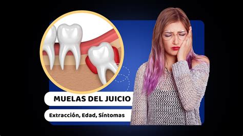 Muelas del juicio Quito Extracción Edad Síntomas precio