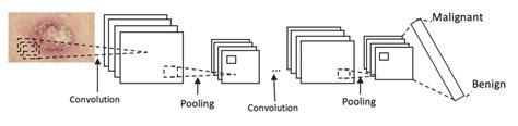optimization of the convolutional neural networks for automatic detection of skin cancer