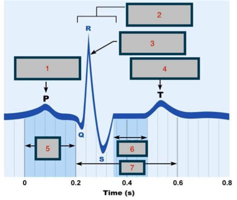 Ekg Flashcards Quizlet
