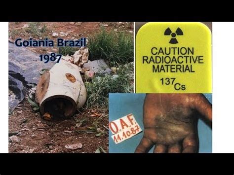The Goiania Cesium 137 Radiological Accident YouTube