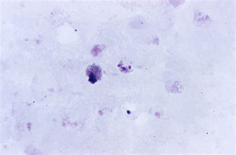 Free Picture Magnified X Thin Film Photomicrograph Blood