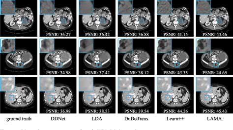 figure 1 from learned alternating minimization algorithm for dual domain sparse view ct