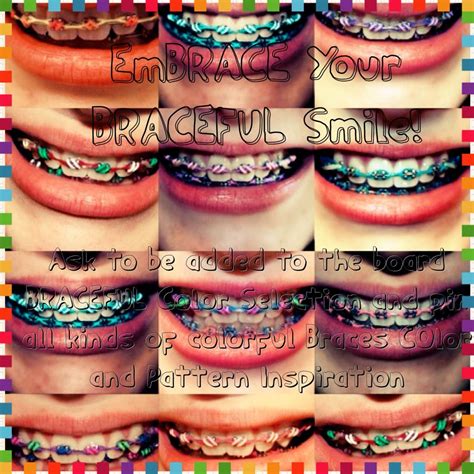 Have Fun Adding Neat Ideas For Braces To Inspire The Next Girl With A